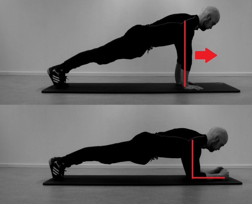 posteriorinen tiltti arkistot