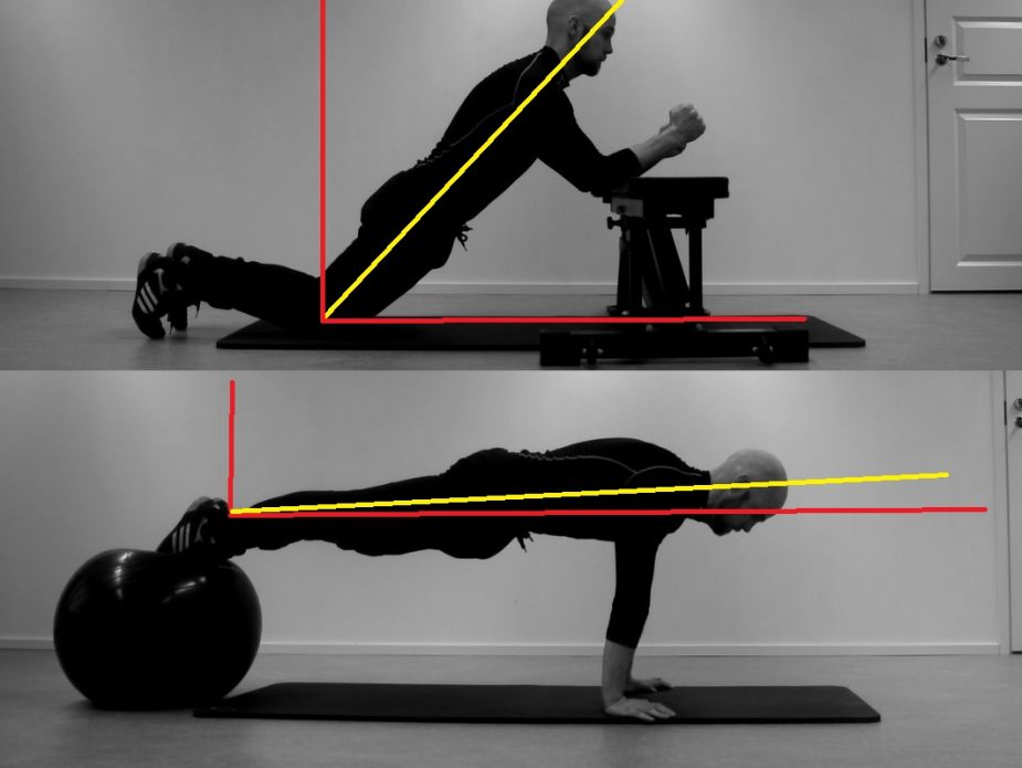 posteriorinen tiltti arkistot